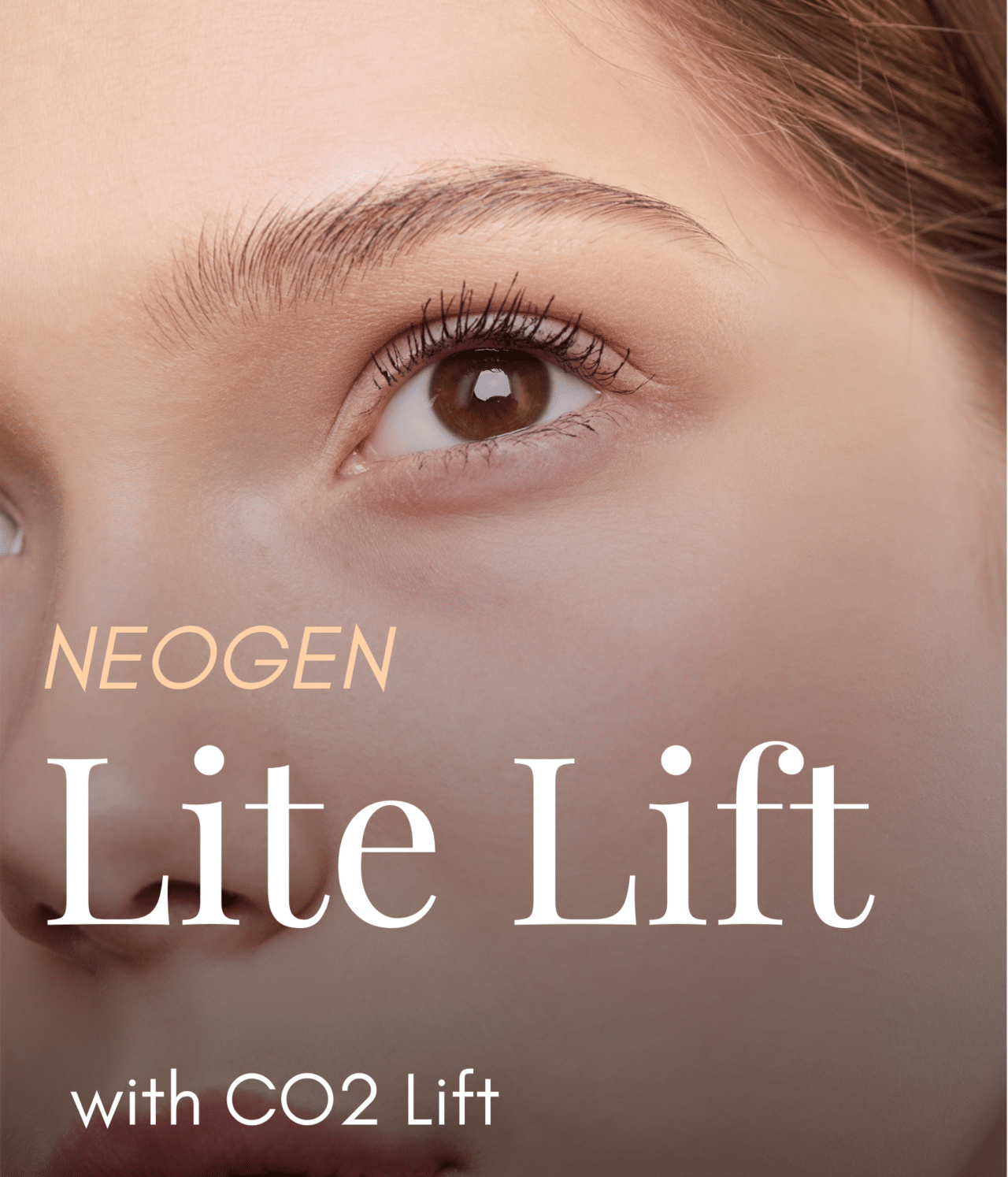 NeoGen Lift | Home