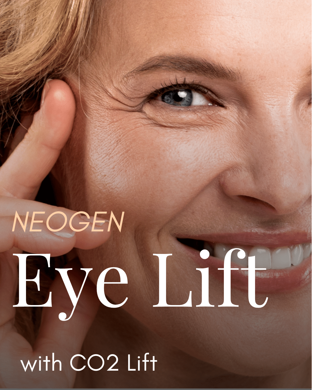NeoGen Lift Treatments | Newport Beach, CA